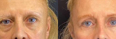 Plastic Surgery & Cosmetic Procedures Pricing | Dr. Demetri MD