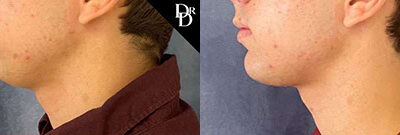 Plastic Surgery & Cosmetic Procedures Pricing | Dr. Demetri MD