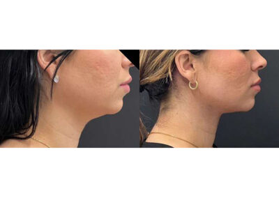 Plastic Surgery & Cosmetic Procedures Pricing | Dr. Demetri MD