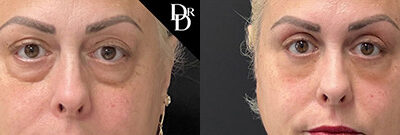 Plastic Surgery & Cosmetic Procedures Pricing | Dr. Demetri MD